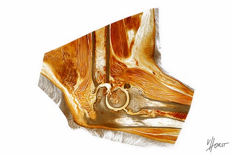 Dog elbow joint pathology print - Plastination Anatomy Embedding